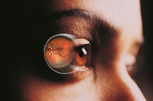 Retinal Photography - Casey Optometrist